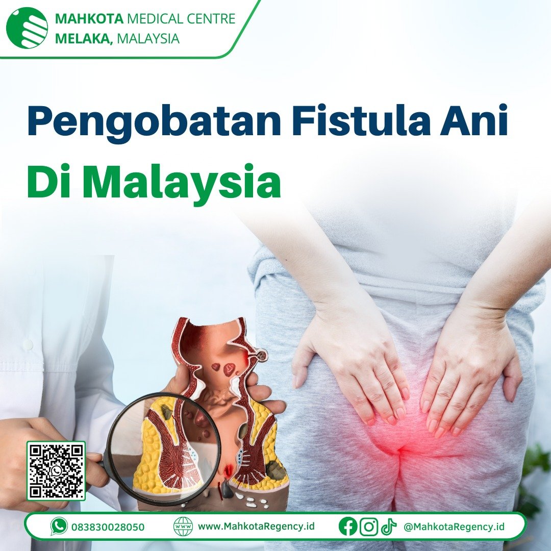 Pengobatan Fistula Ani Di Malaysia | MahkotaRegency.Id